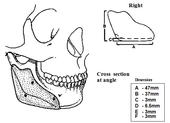 Angle Of Mandible