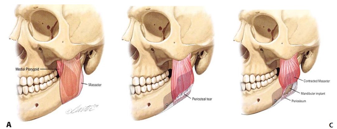 Inferior Border Of Mandible